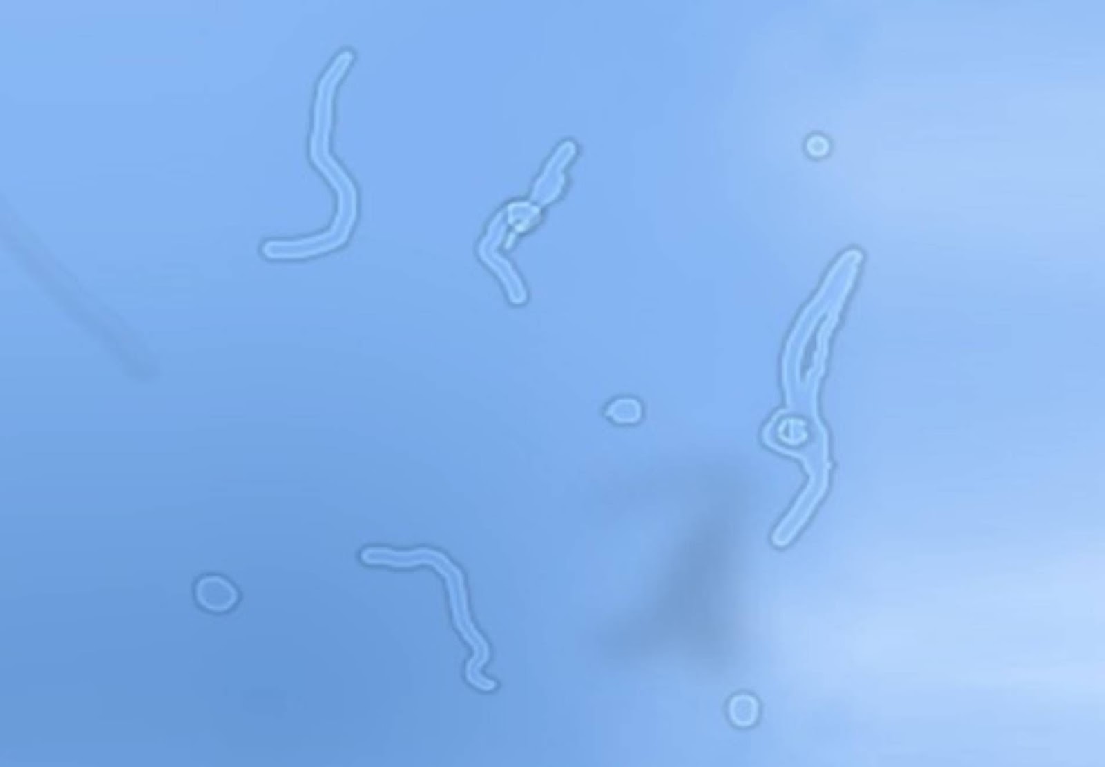 Zie jij ook ‘floaters’ in je ogen? Dít is wat er écht aan de hand is ...